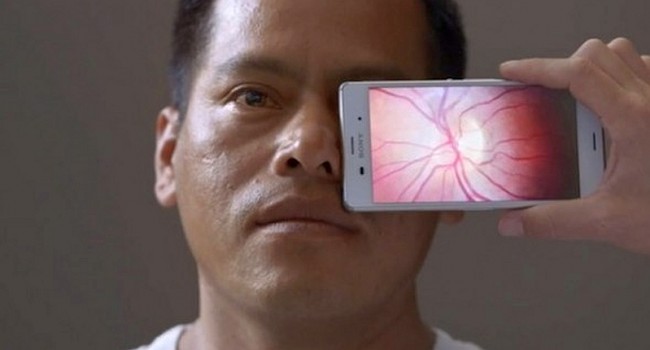 New smartphone device aims to prevent blindness - Gearburn